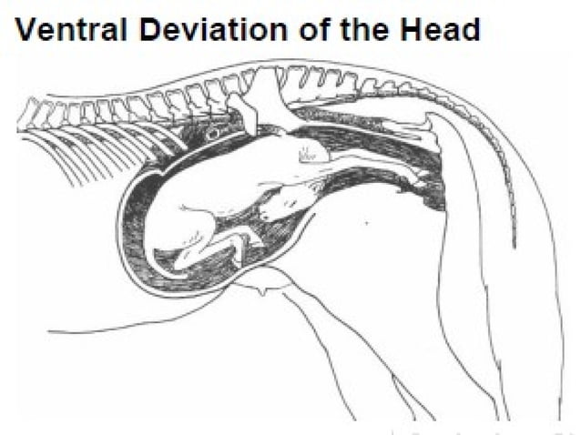 Fetal causes of dystocia | PPT