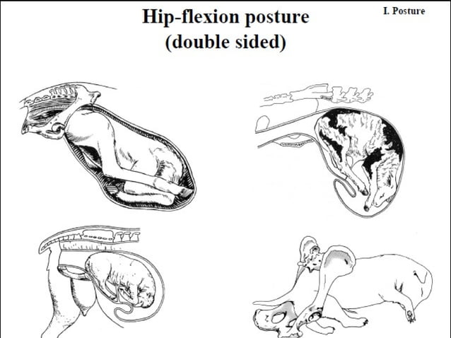 Fetal causes of dystocia | PPT