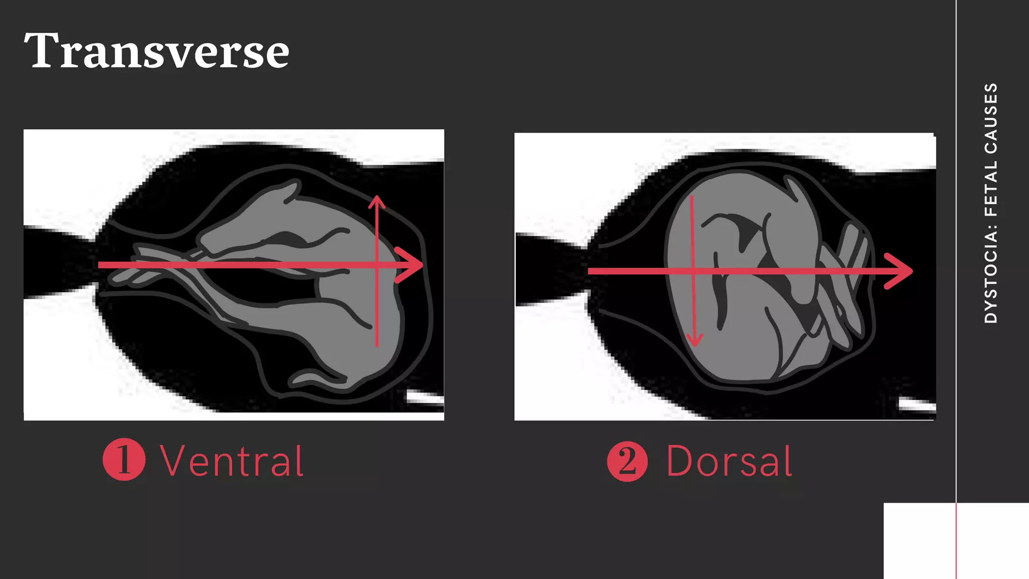 Fetal causes of dystocia in farm animals | PDF