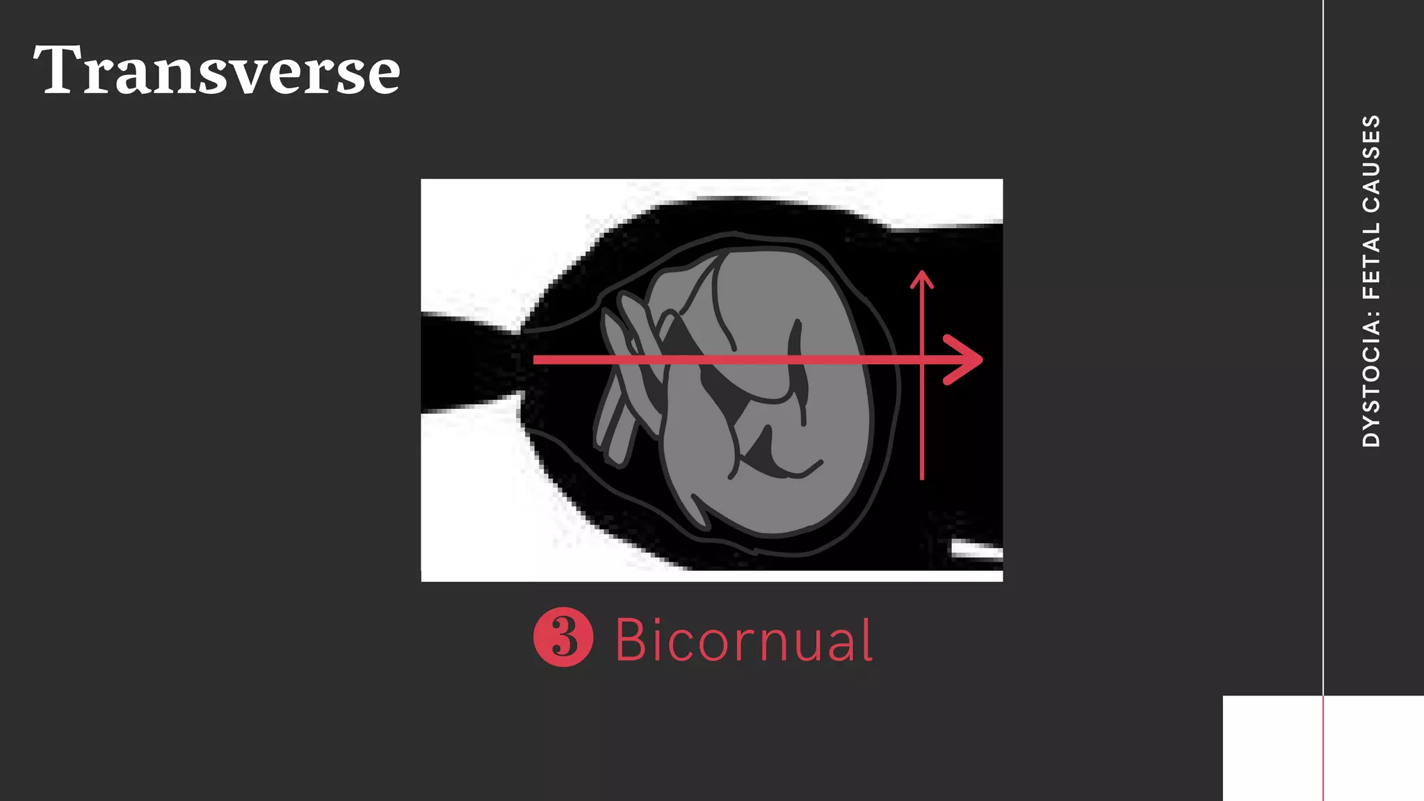 Fetal causes of dystocia in farm animals | PDF