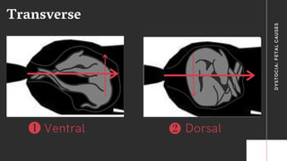 Fetal causes of dystocia in farm animals | PDF
