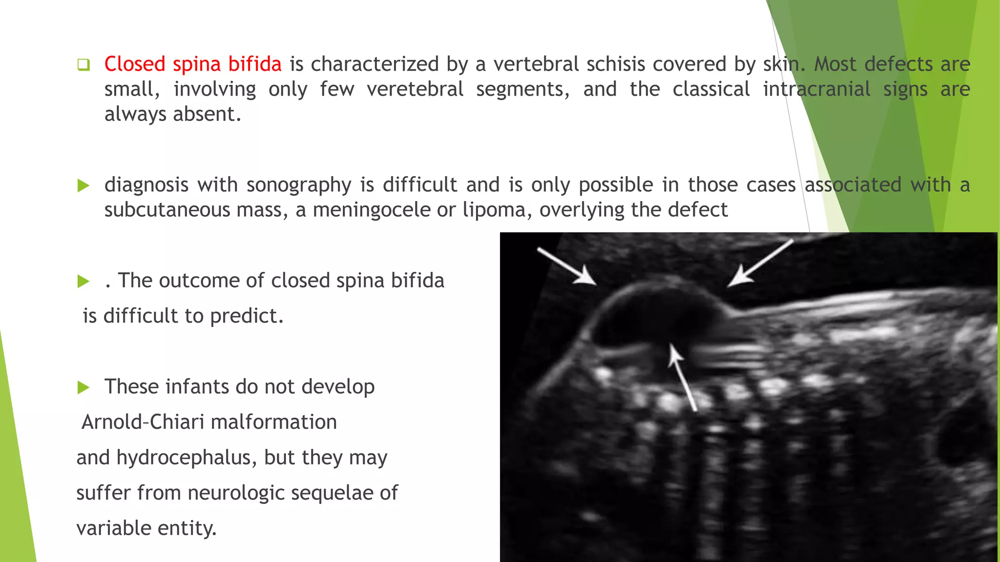 Fetal central nervous system anomalies | PPT