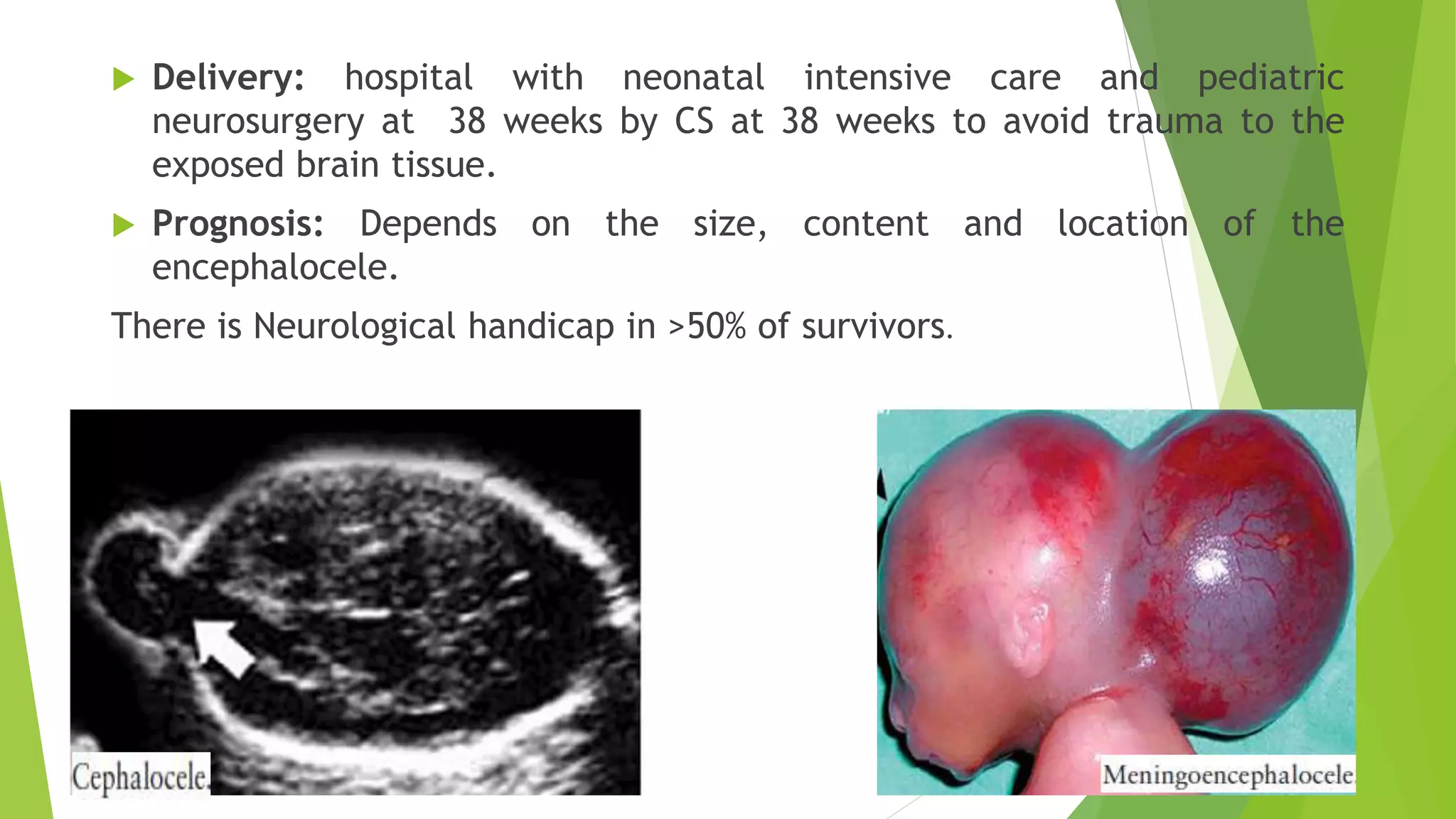 Fetal central nervous system anomalies | PPT