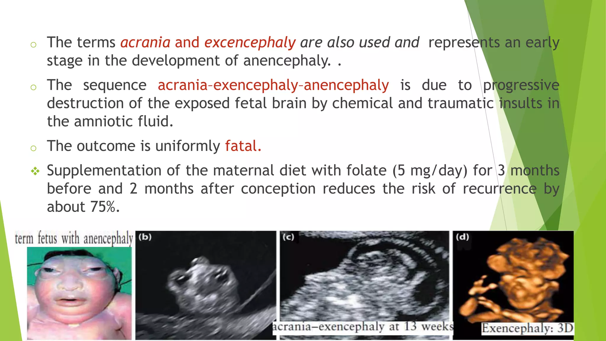 Fetal central nervous system anomalies | PPT