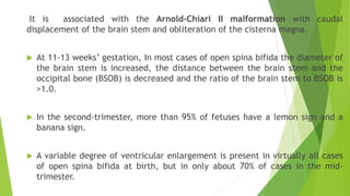 Fetal central nervous system anomalies | PPT