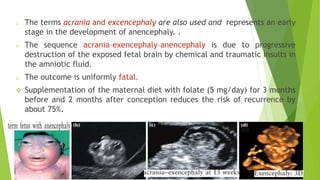 Fetal central nervous system anomalies | PPT