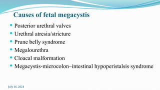 Fetall chest and abdomen anomaliess.pptx