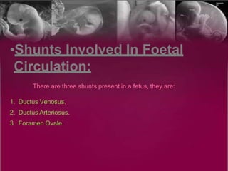 fetal circulation.pptx