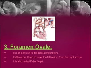 fetal circulation.pptx