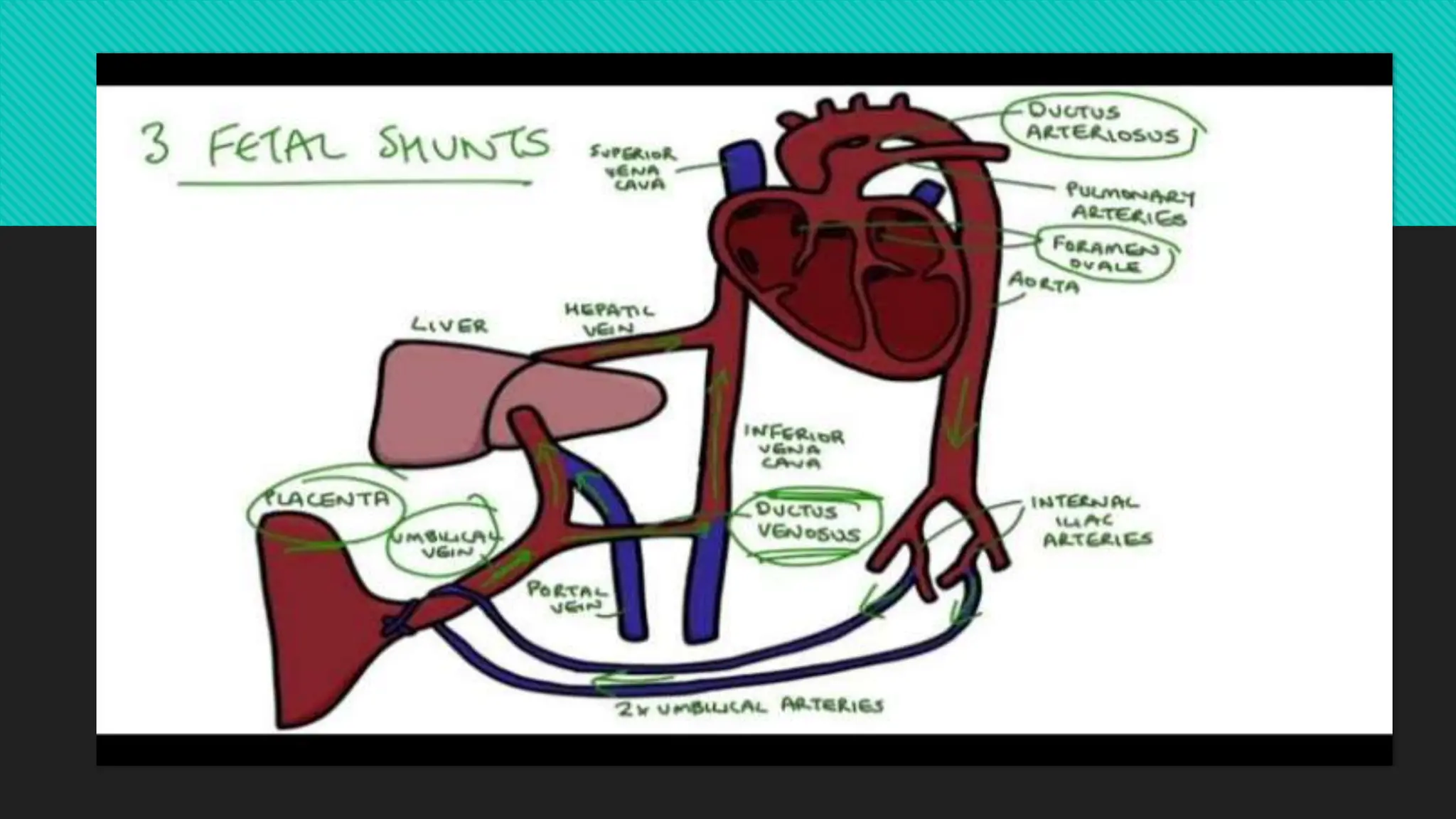 fetal circulation.pptx
