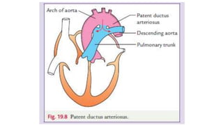 Fetal circulation - Copy.pptx