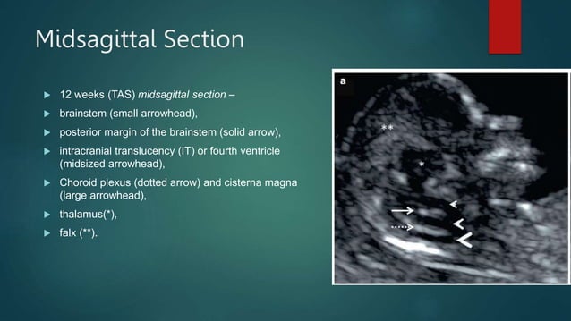 Fetal cns ppt.pptx