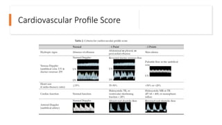 Fetal Congestive Heart Failure .pptx