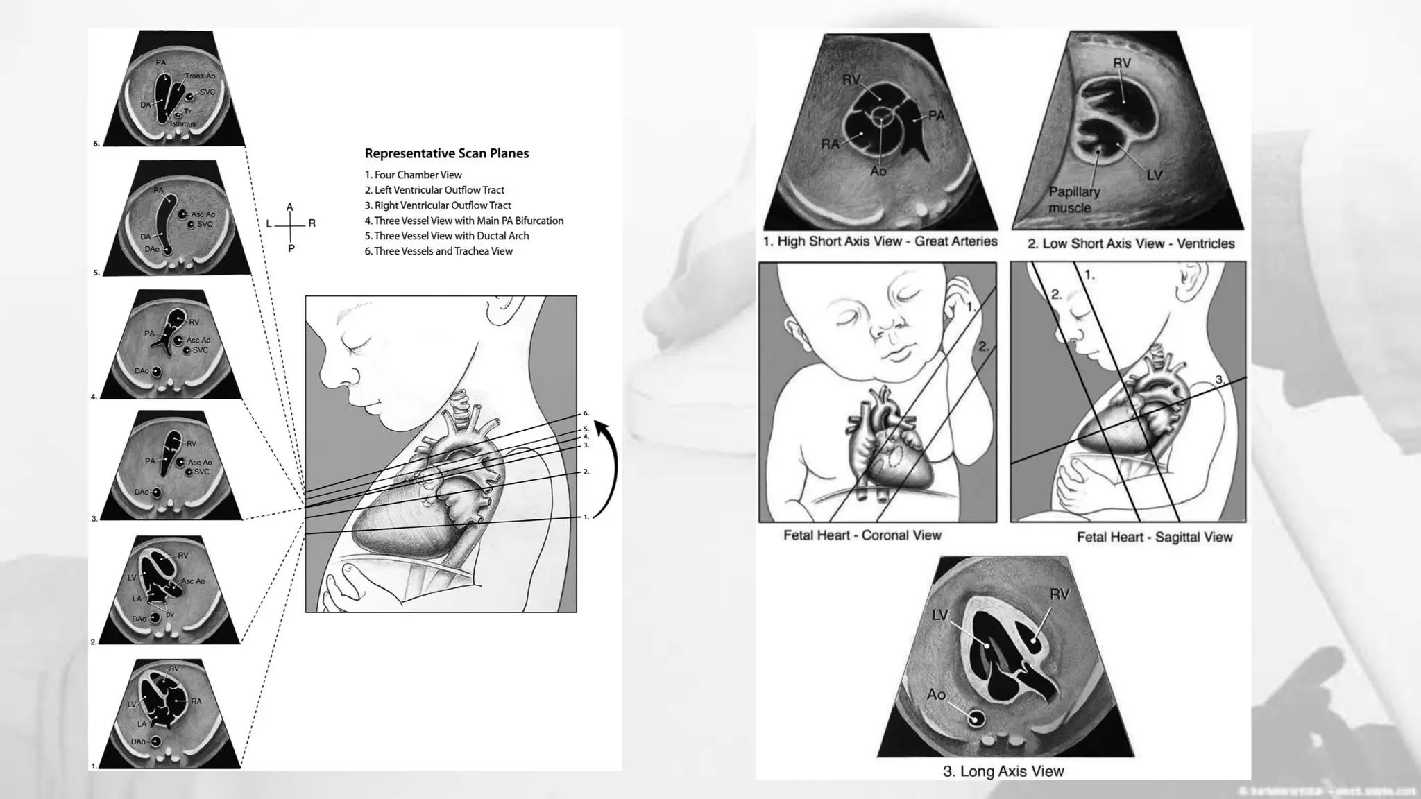FETAL ECHOCARDIOGRAPHY-006.pptx