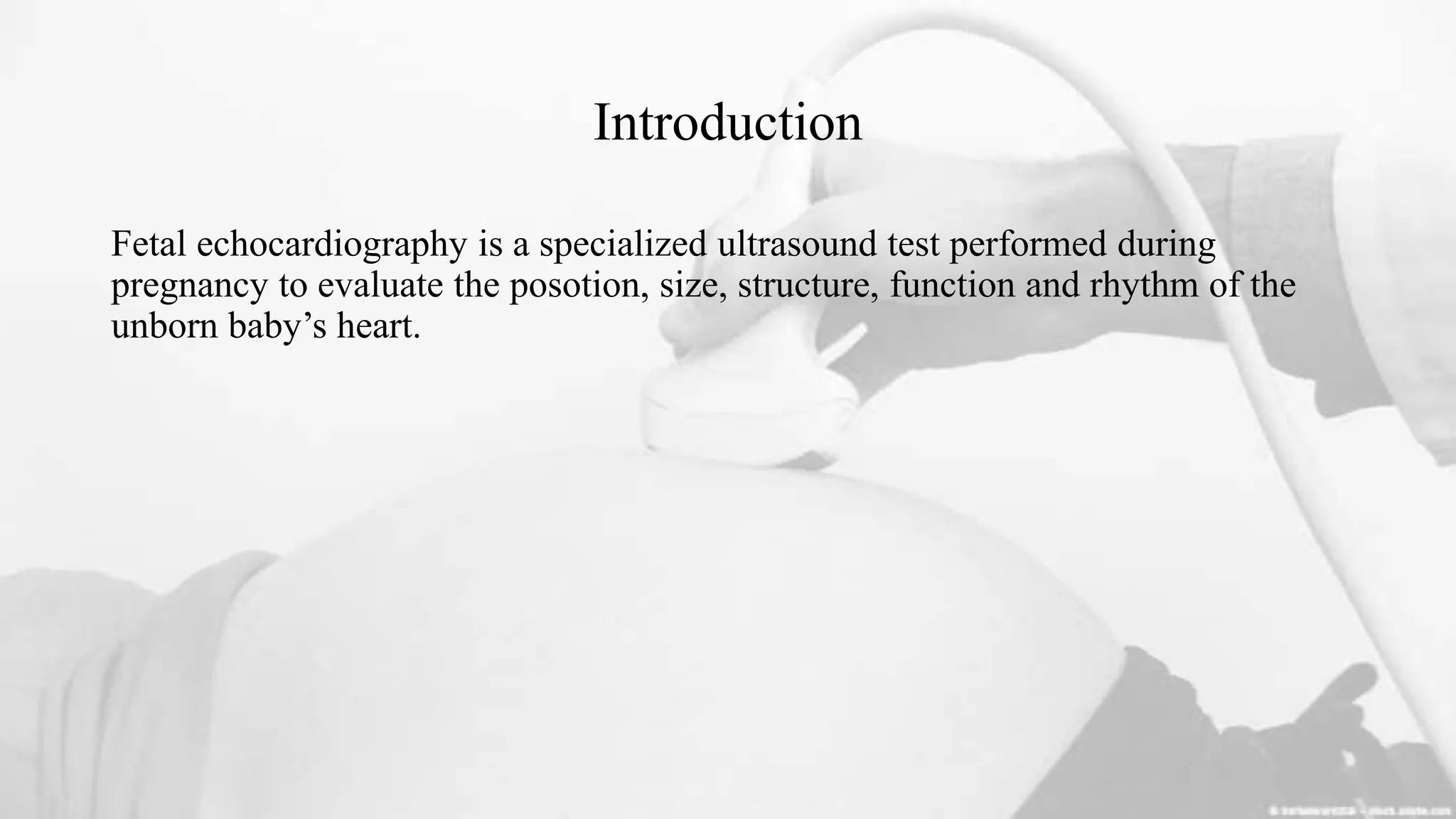 FETAL ECHOCARDIOGRAPHY-006.pptx