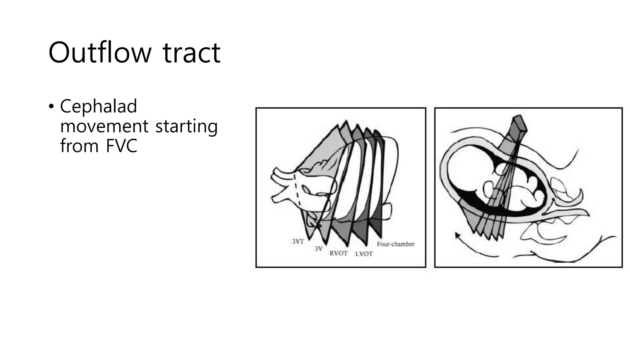 Fetal echocardiography | PPTX