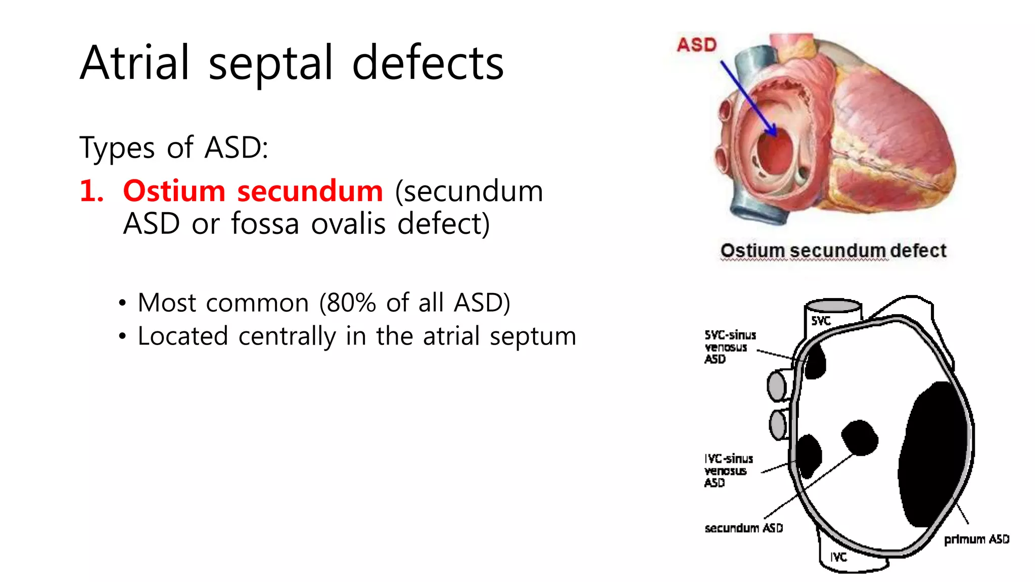 Fetal echocardiography | PPTX
