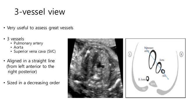 Fetal echocardiography