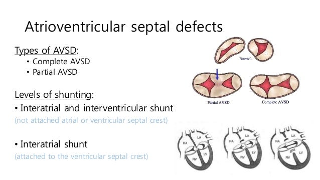 Fetal echocardiography