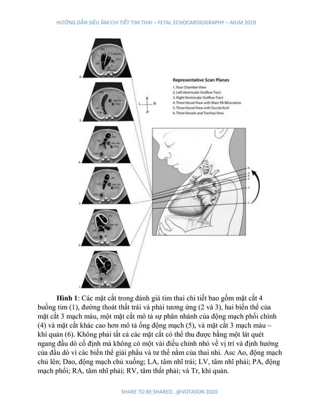 Fetal echocardiography aium 2019 | PDF