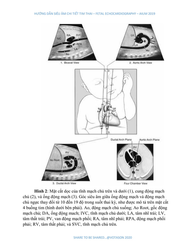 Fetal echocardiography aium 2019 | PDF