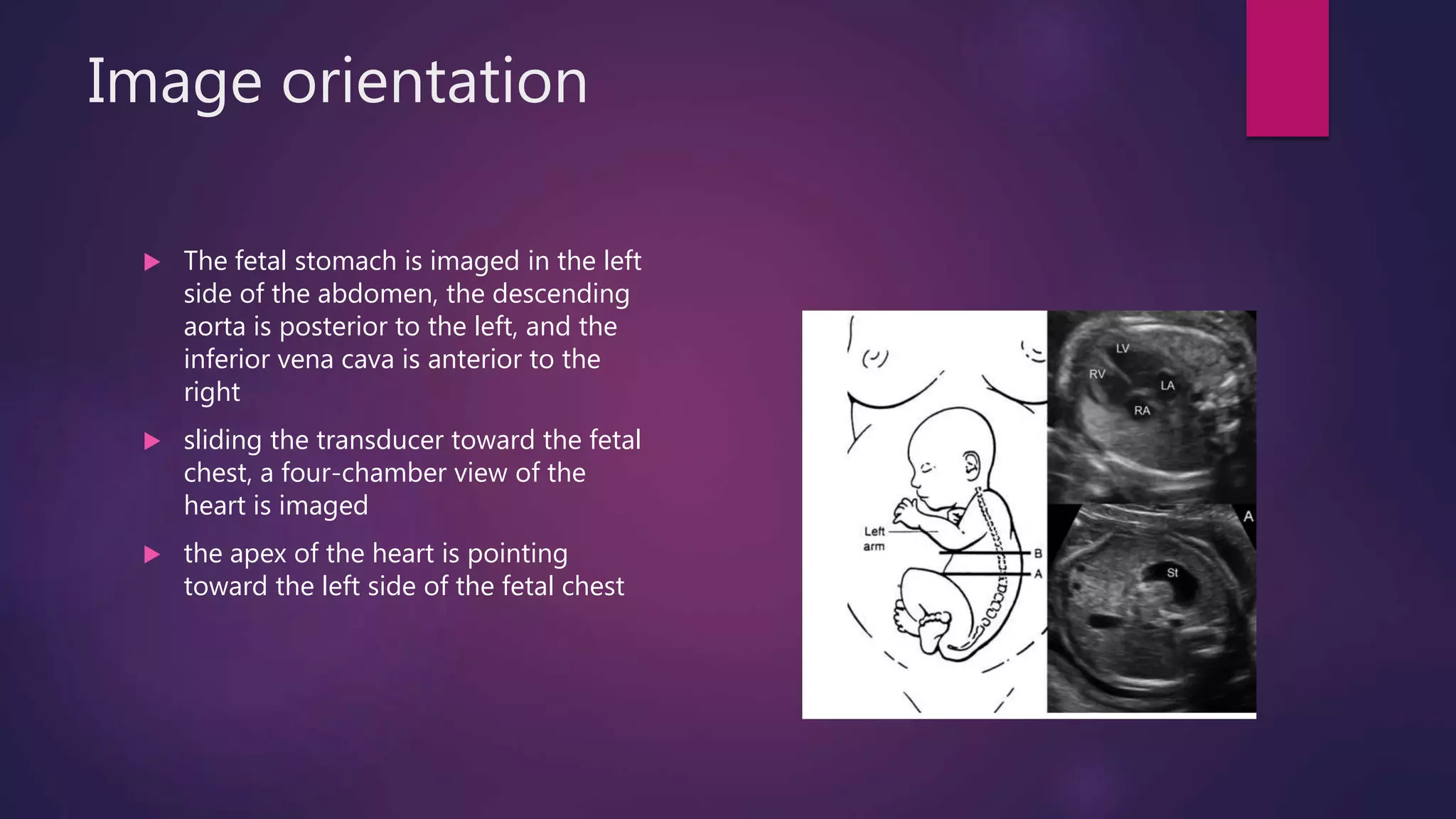 Fetal Echocardiography: Basics and Advanced | PPTX