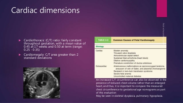 Fetal Echocardiography: Basics and Advanced