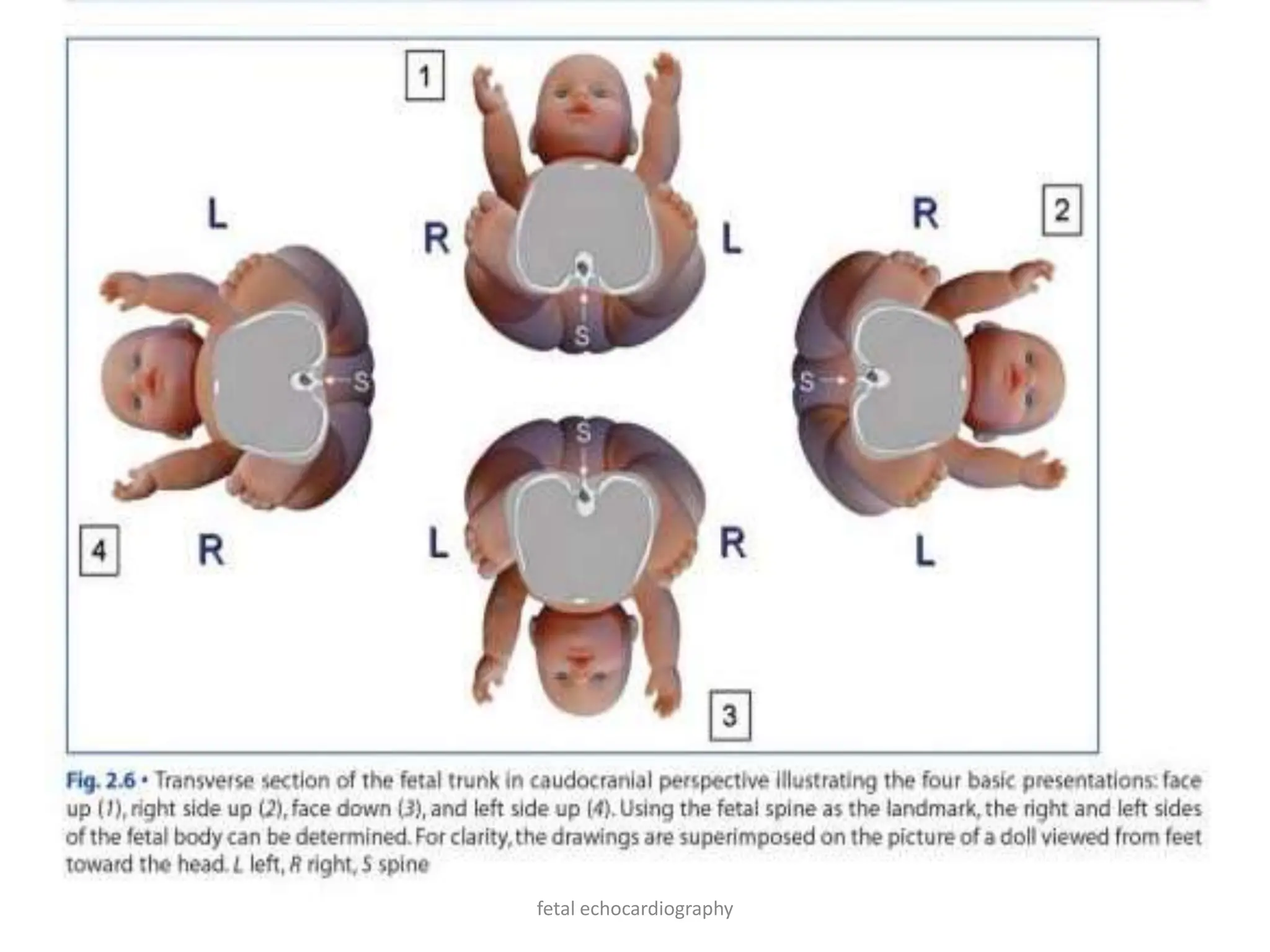 fetal echocardiography ppt.pptx........... | PPTX