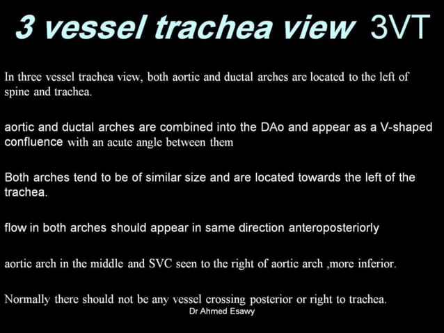 Fetal echo three vessel trachea view 3 vt dr ahmed esawy | PPT