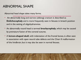 Ultrasound to evaluate Fetal face and neck. ASW.pptx