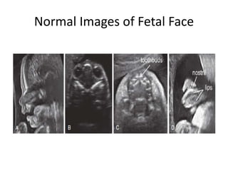 Fetal face and necK | PPTX
