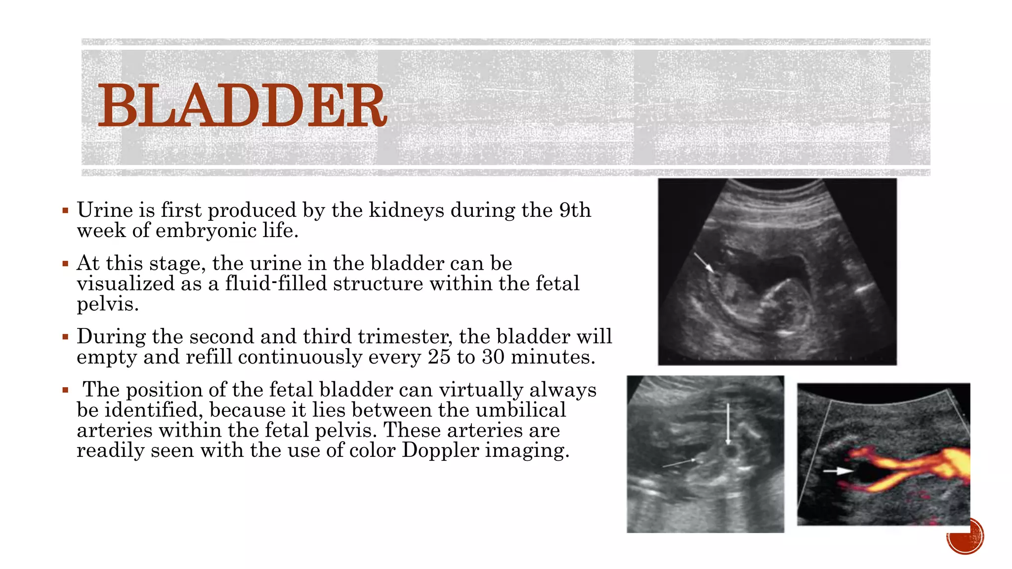 Fetal genitourinary | PPTX