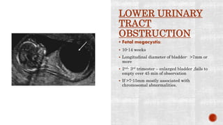 Fetal genitourinary | PPTX