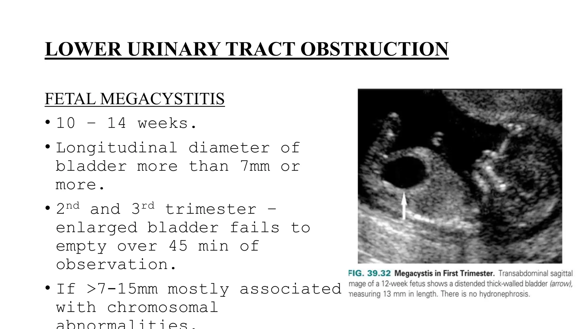 Radiology of Fetal genitourinary tract.pptx