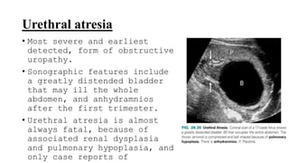 Radiology of Fetal genitourinary tract.pptx