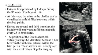Radiology of Fetal genitourinary tract.pptx