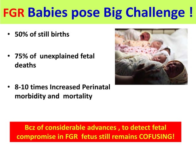 FETAL GROWTH RETARDATION In Modern Practice –Made Simple | PPTX ...