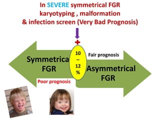 FETAL GROWTH RETARDATION In Modern Practice –Made Simple | PPTX