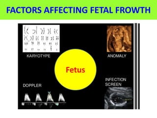 FETAL GROWTH RETARDATION In Modern Practice –Made Simple | PPTX