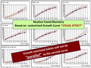 FETAL GROWTH RETARDATION In Modern Practice –Made Simple | PPTX
