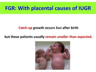 FETAL GROWTH RETARDATION In Modern Practice –Made Simple | PPTX