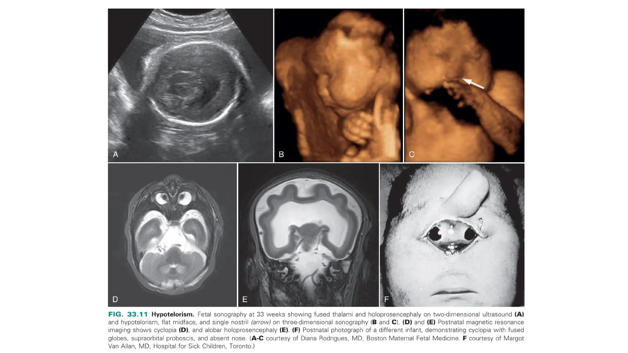 fetal head and neck imaging and spotters | PPTX