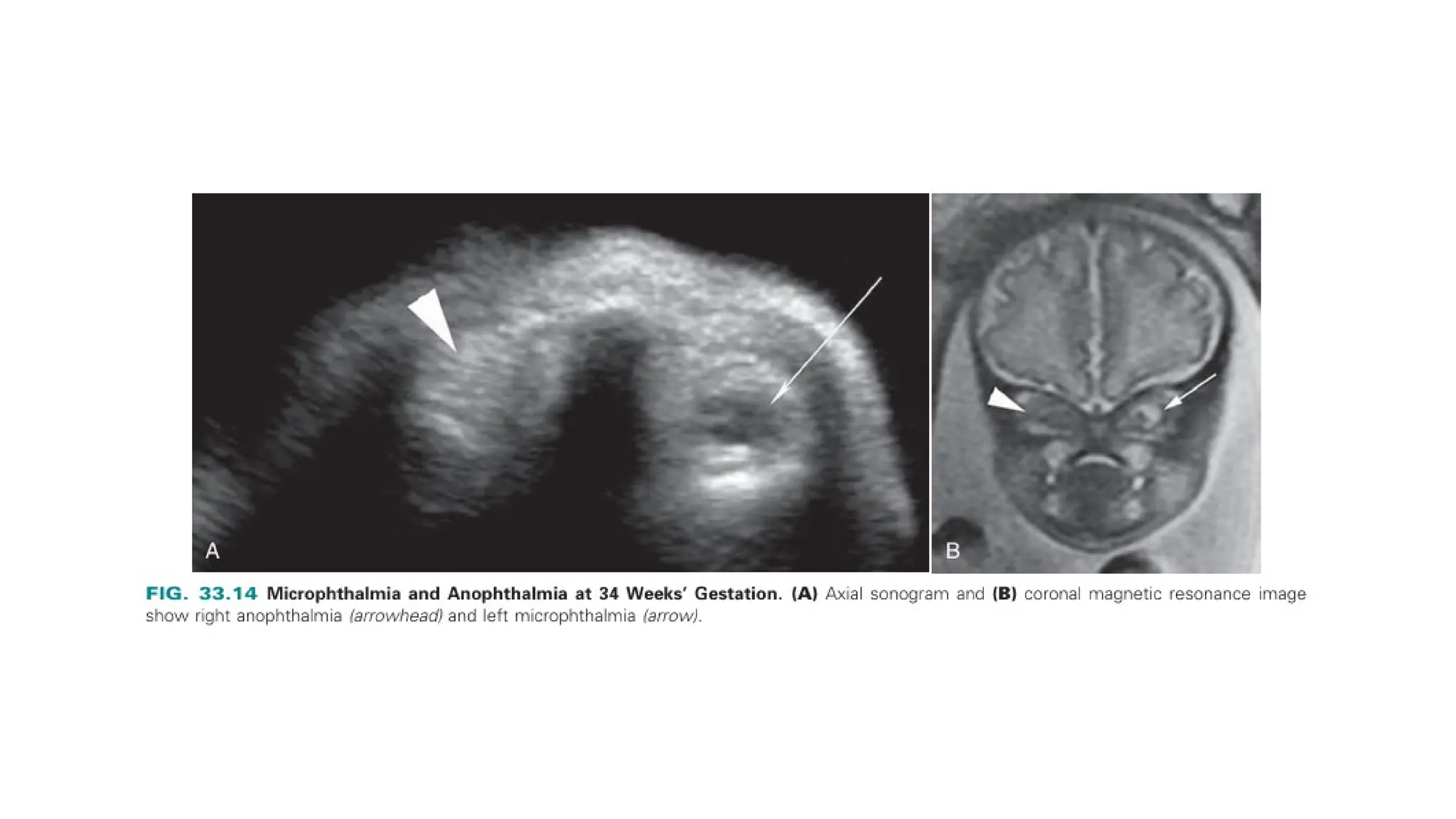 fetal head and neck imaging and spotters | PPTX