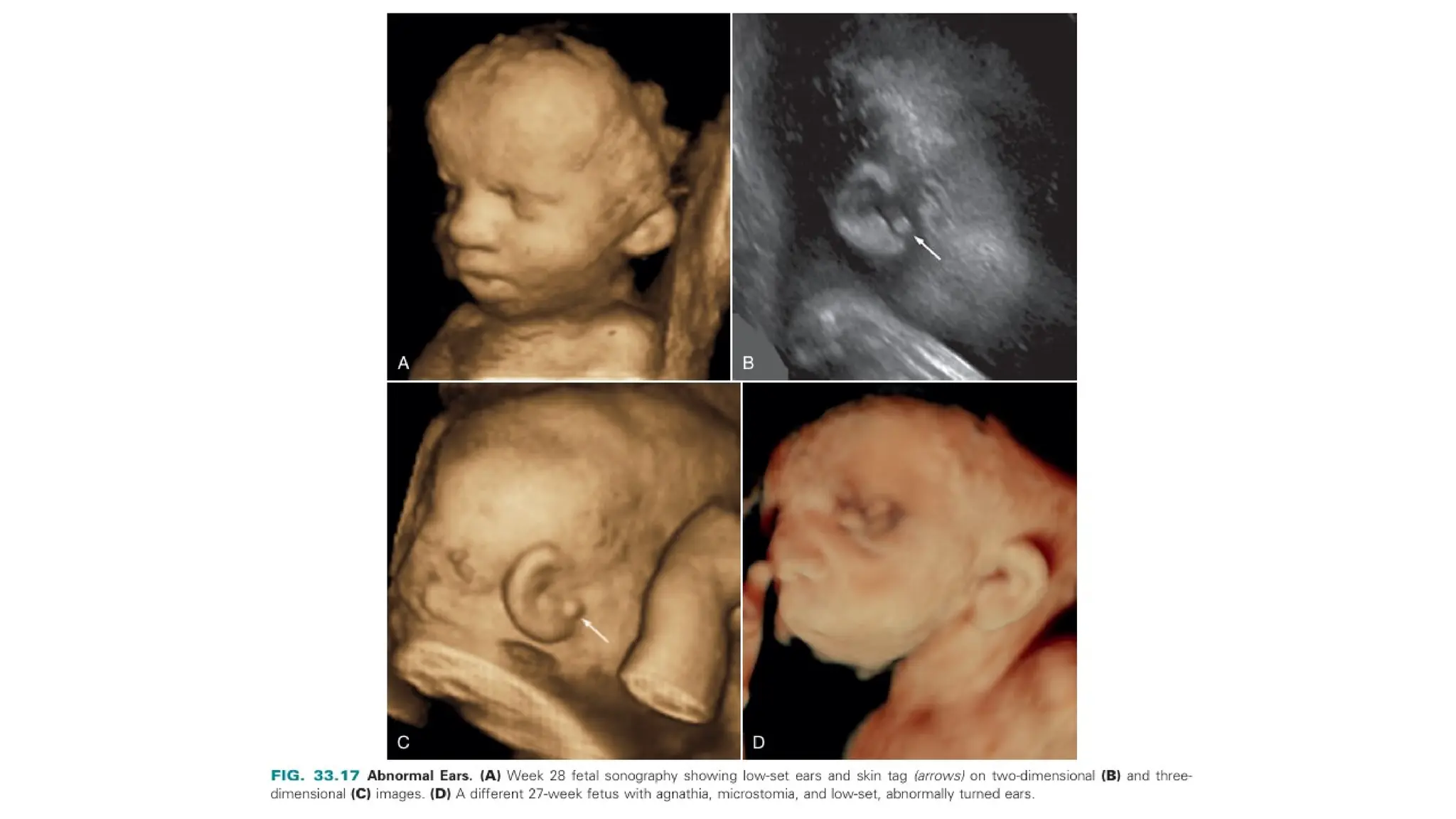 fetal head and neck imaging and spotters | PPTX