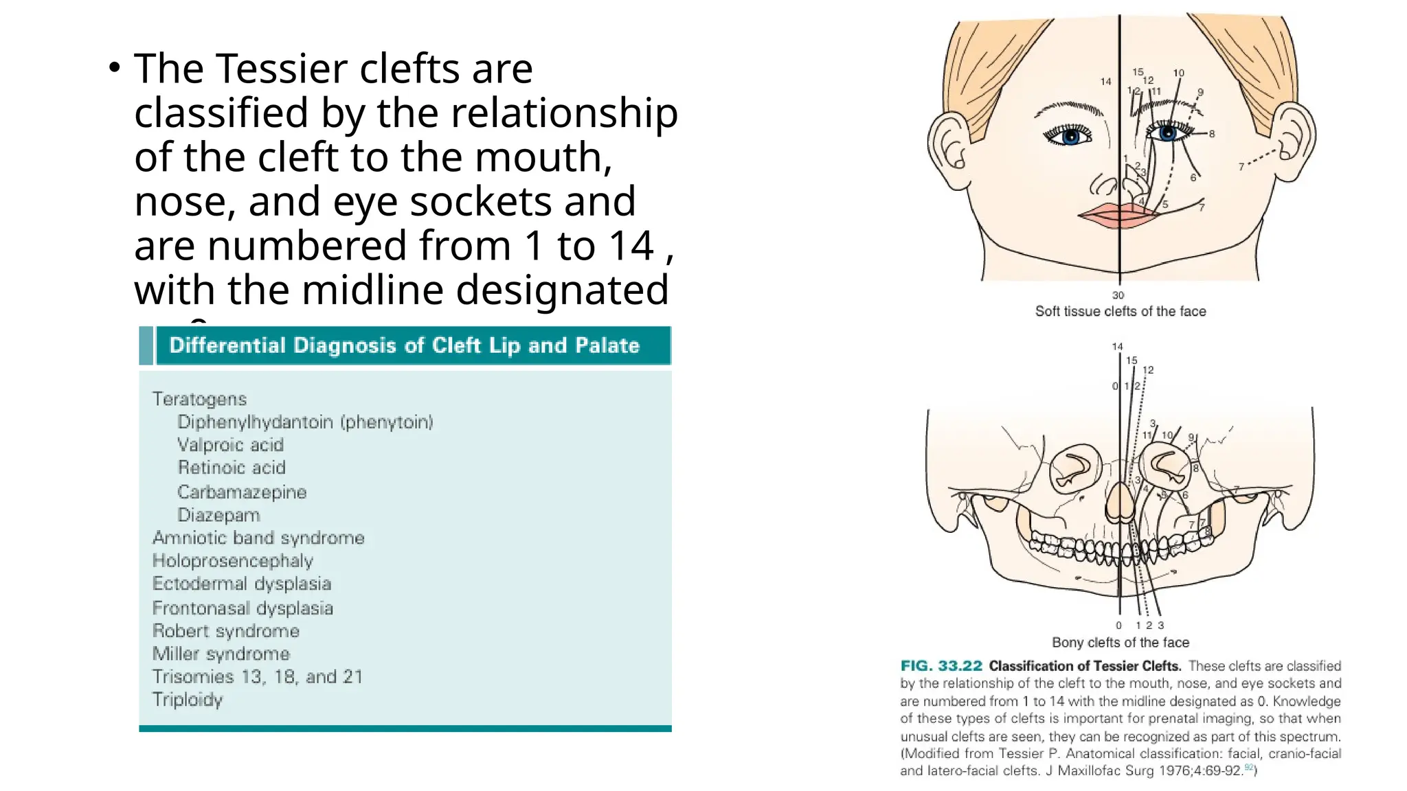 fetal head and neck imaging and spotters | PPTX
