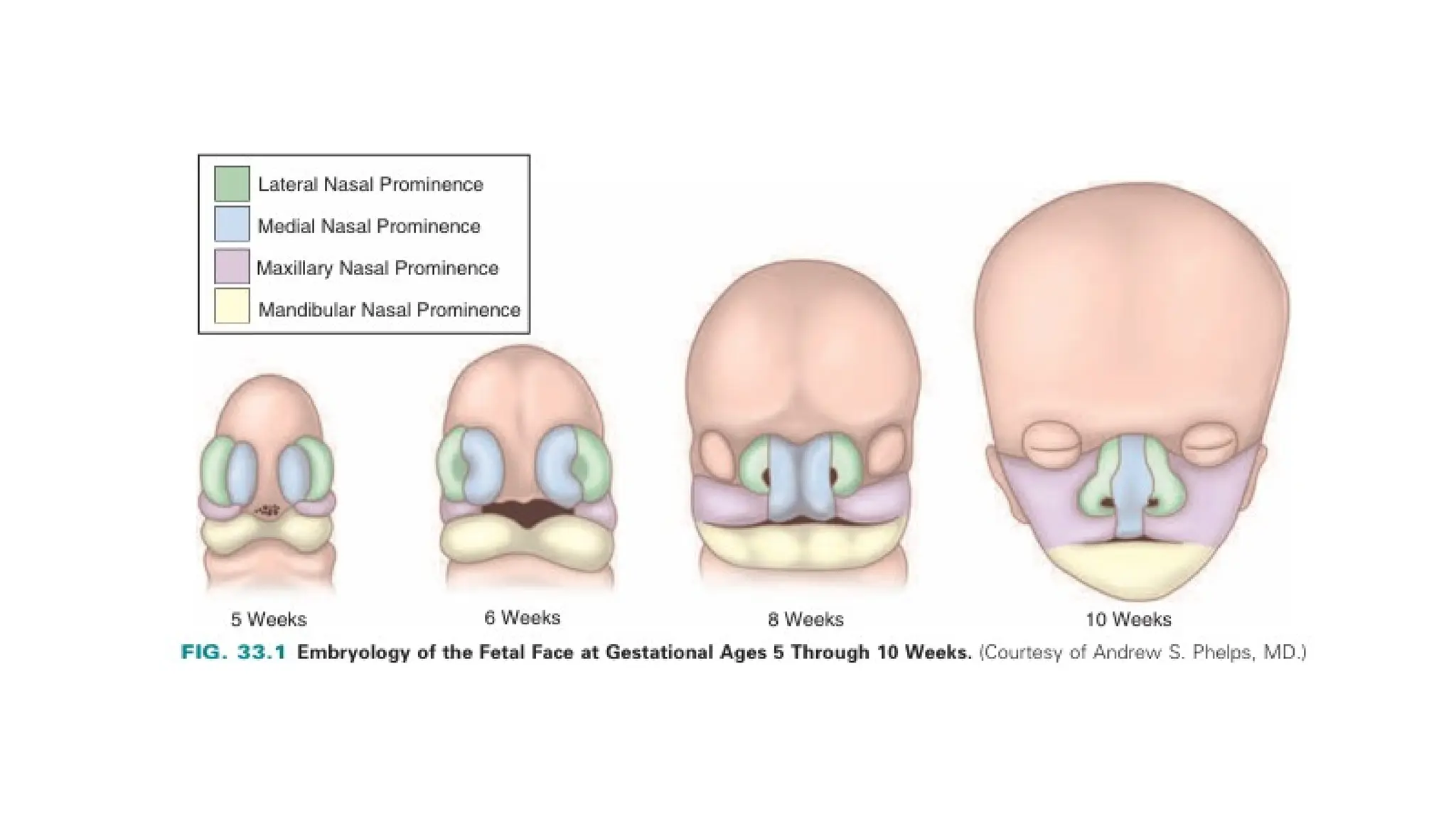 fetal head and neck imaging and spotters | PPTX