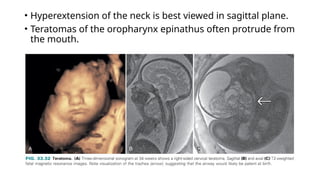fetal head and neck imaging and spotters | PPTX
