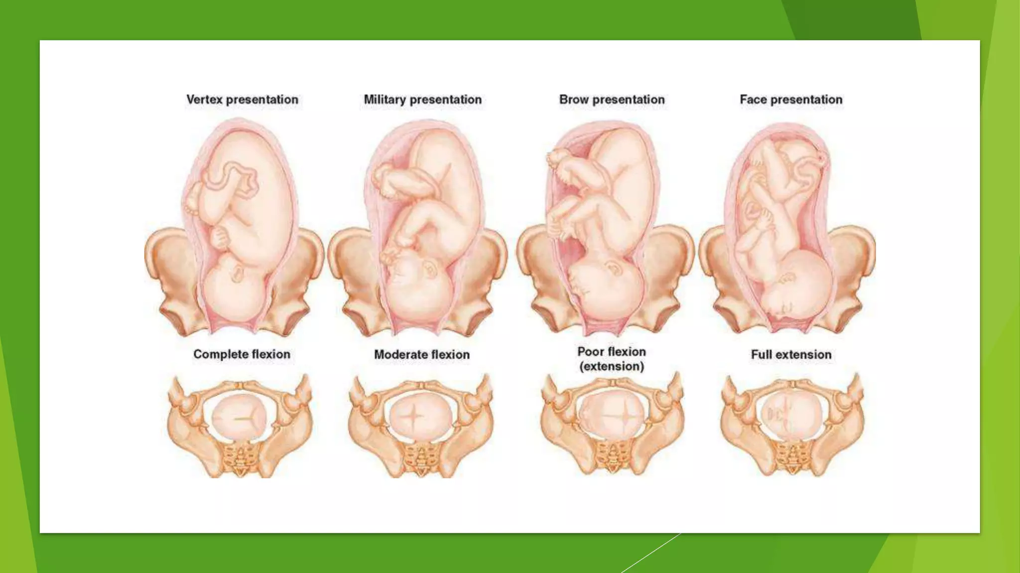 Fetal head diameters | PPTX
