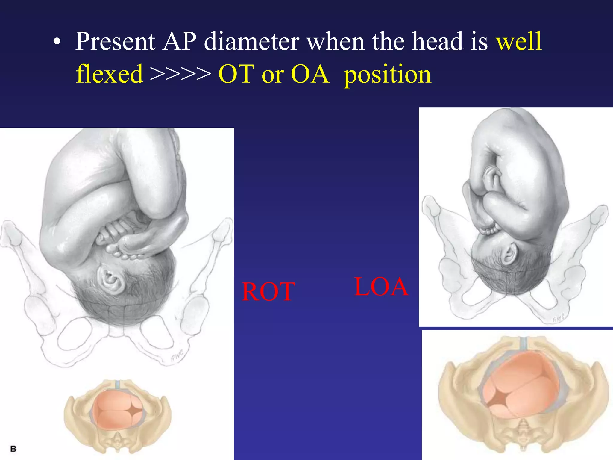 Fetal head, maternal pelvis & pelvimetry | PPTX