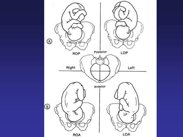 Fetal head, maternal pelvis & pelvimetry | PPTX